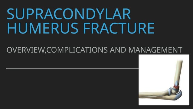 SUPRACONDYLAR FRACTURES OF HUMERUS IN CHILDREN.pptx