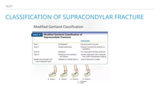 SUPRACONDYLAR FRACTURES OF HUMERUS IN CHILDREN.pptx
