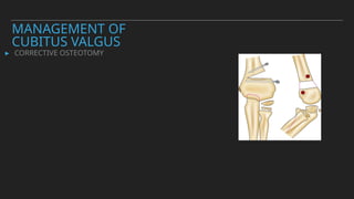 SUPRACONDYLAR FRACTURES OF HUMERUS IN CHILDREN.pptx