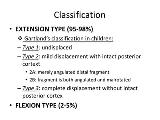 Supracondylar fractures in children | PPTX