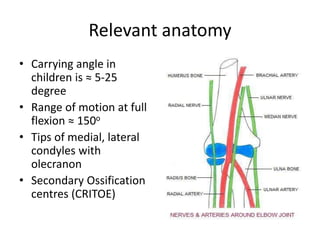 Supracondylar fractures in children | PPTX