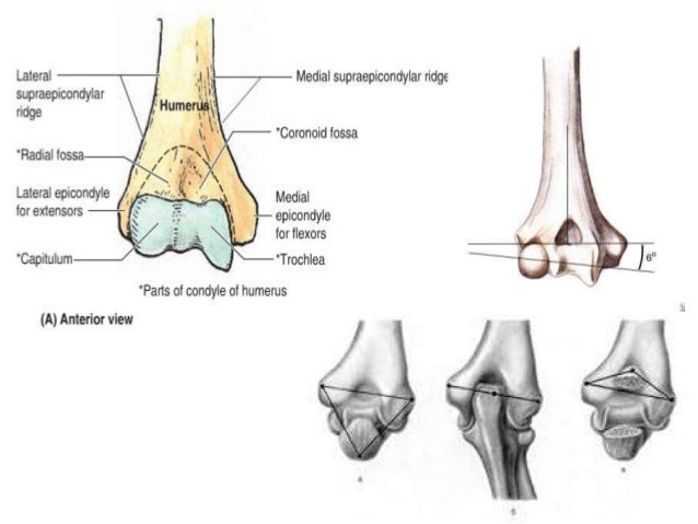 Supracondylar fractures in children