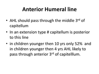 Supracondylar fractures of the distal humerus | PPT