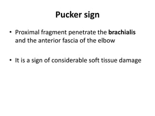 Supracondylar fractures of the distal humerus | PPT