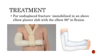 supracondylar fracture treatment and complications.pptx