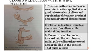 supracondylar fracture treatment and complications.pptx