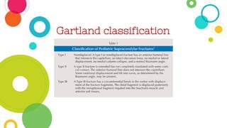 Supracondylar fracture | PDF