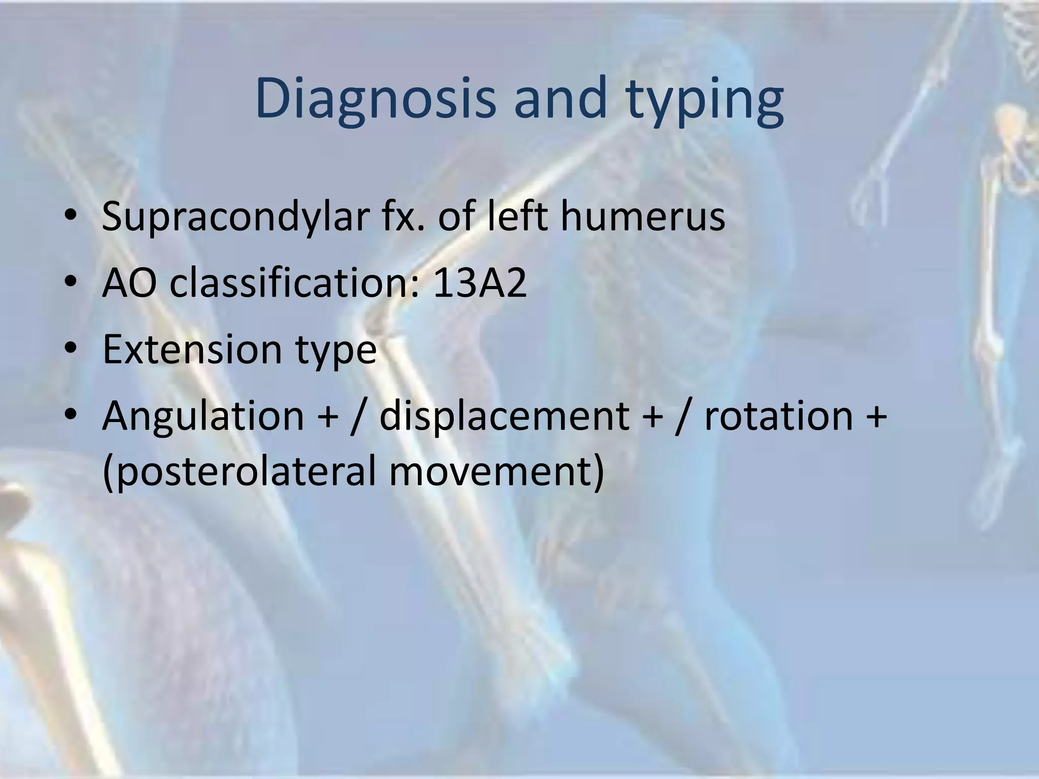 Supracondylar Fracture Of Humerus PPTX Supracondylar Fracture Of Humerus PPTX