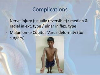 Supracondylar fracture of Humerus | PPTX