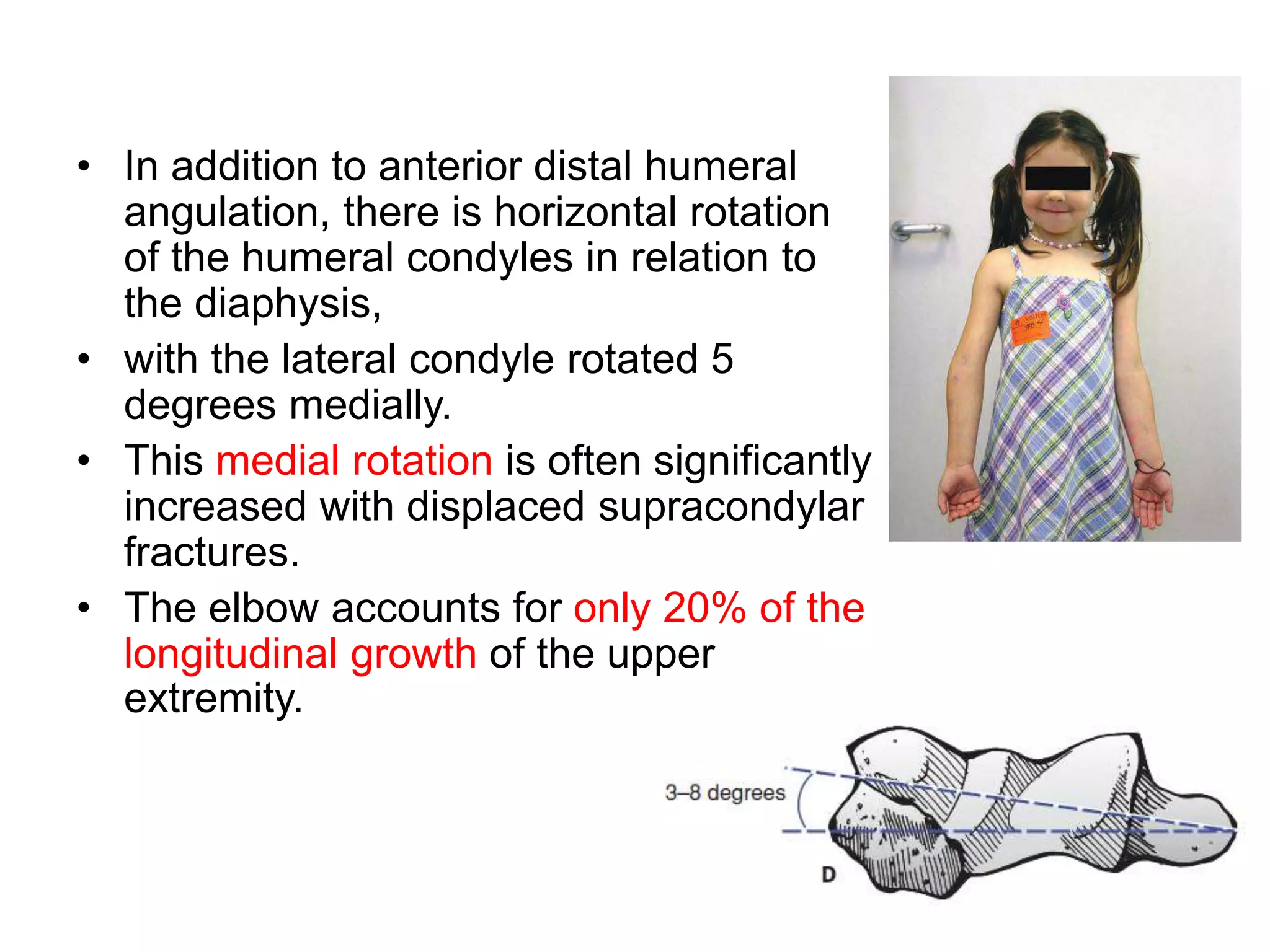 Supracondylar humeral fracture | PPTX