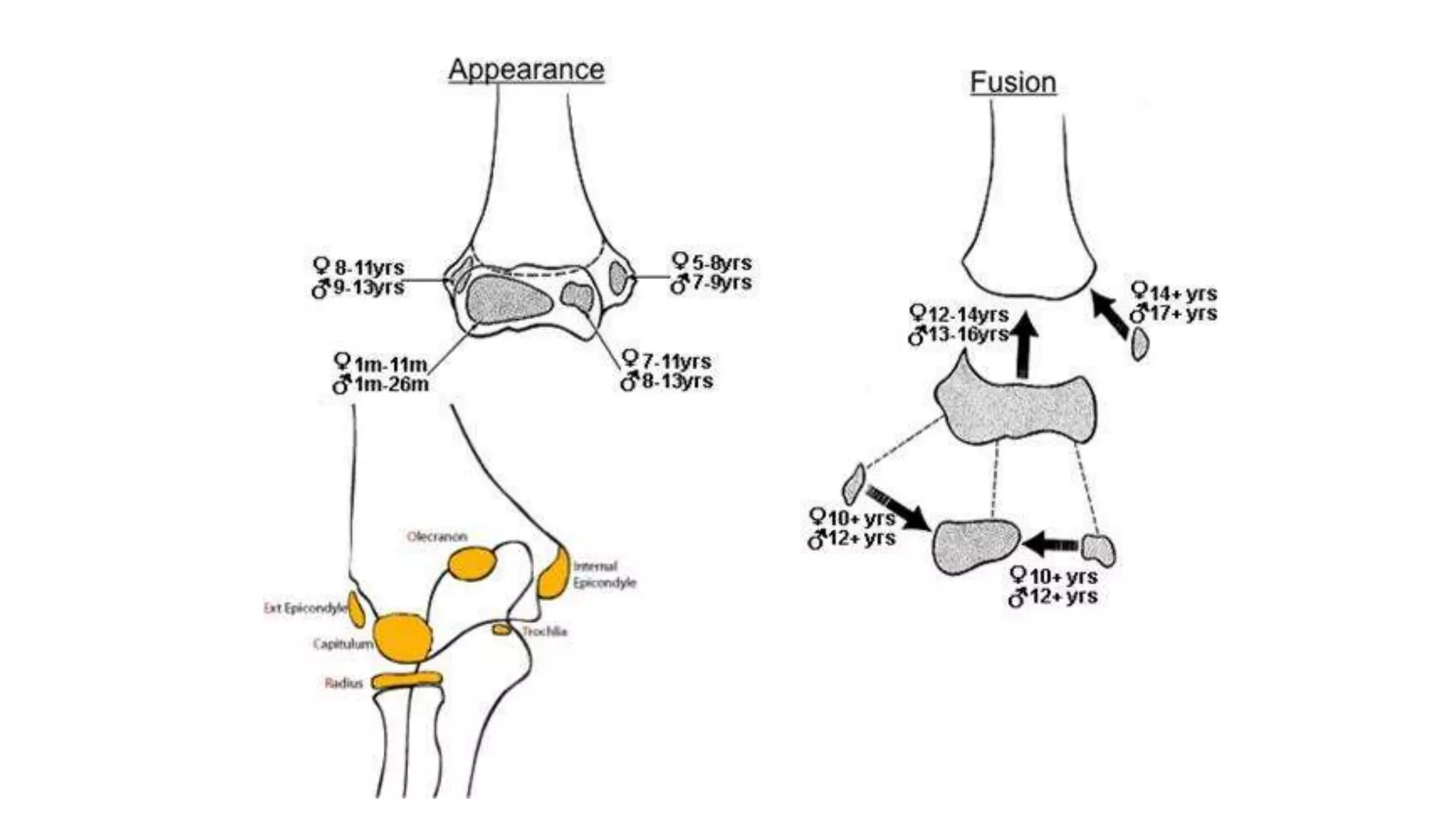 Supracondylar humerus fracture percutaneous pinning video demo | PPTX ...