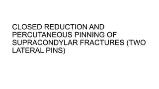 Supracondylar humerus fracture percutaneous pinning video demo | PPT