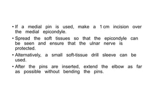 Supracondylar humerus fracture percutaneous pinning video demo | PPTX