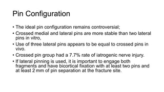 Supracondylar humerus fracture percutaneous pinning video demo | PPT