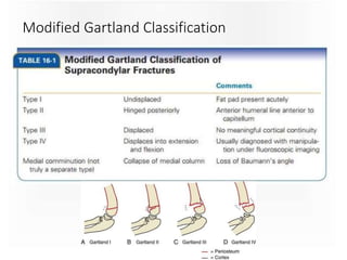 Supracondylar humerus fracture & complication for MBBS students | PPTX