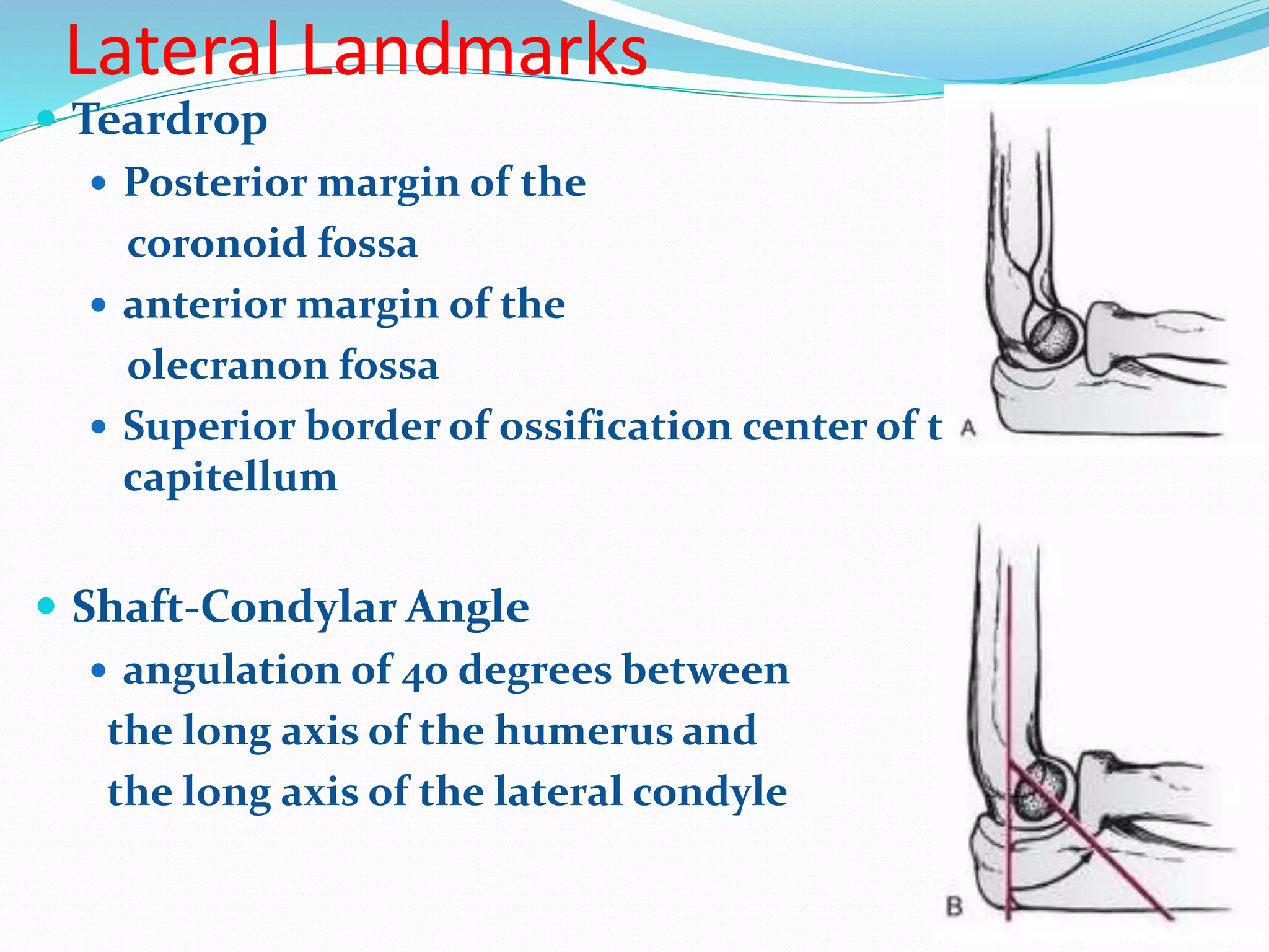 Supra condylar humerus fracture in children | PPTX