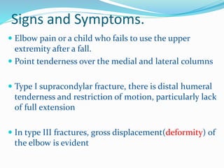 Supra condylar humerus fracture in children | PPTX