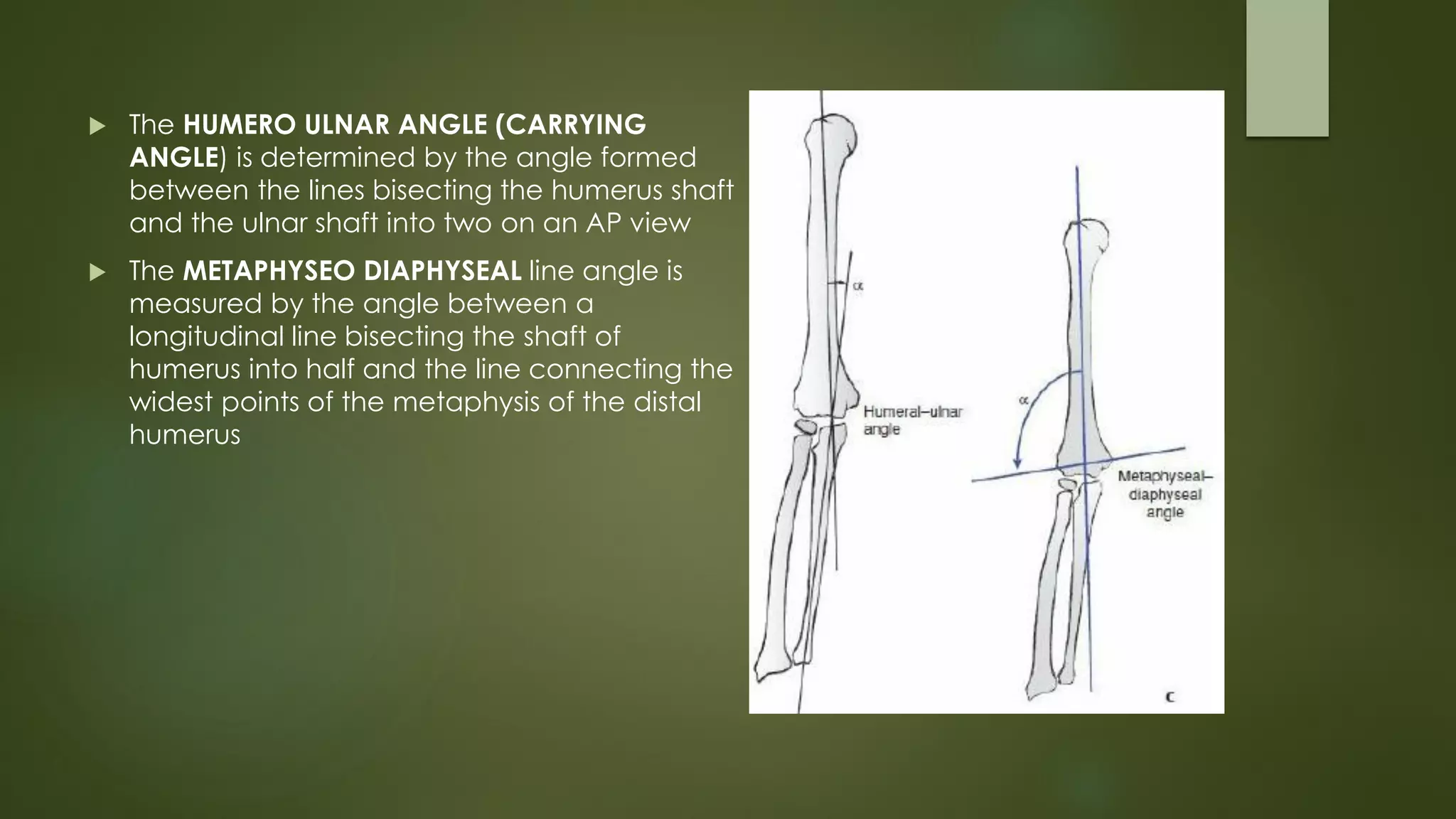 Supracondylar humerus fractures in children | PDF
