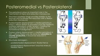 Supracondylar humerus fractures in children | PDF
