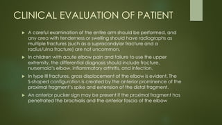 Supracondylar humerus fractures in children | PDF
