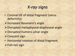 Supracondylar humerus fractures in children | PPTX