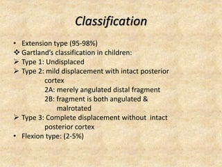 Supracondylar humerus fractures in children | PPTX
