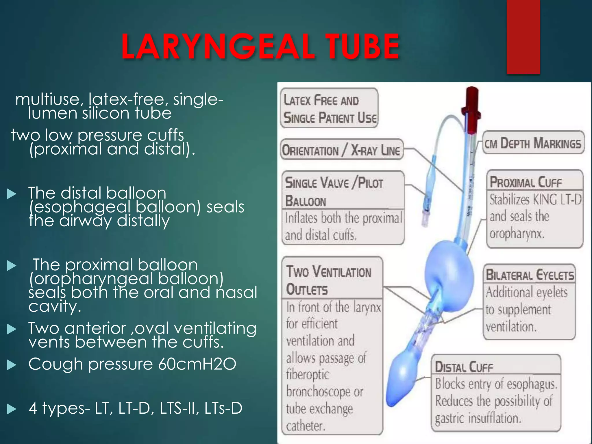 Supraglottic airway device | PPTX