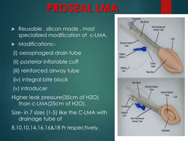Supraglottic airway device | PPTX