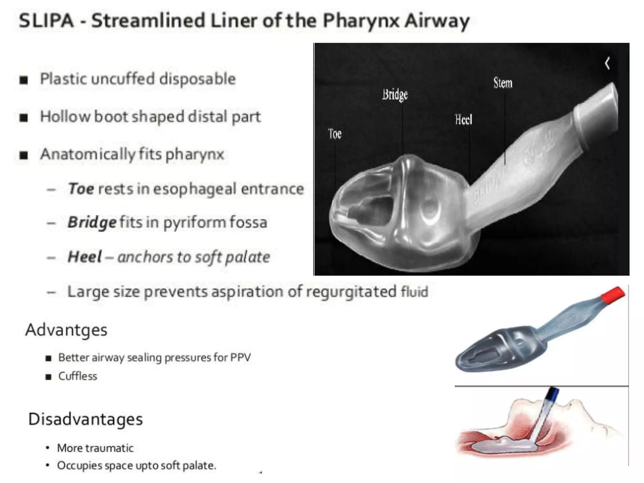 Supraglottic airway devices | PPTX