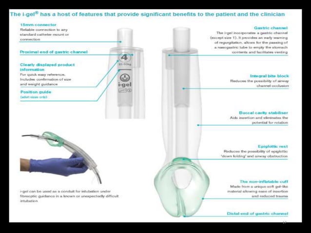 Supraglottic airway devices | PPTX | Ear, Nose and Throat Conditions ...