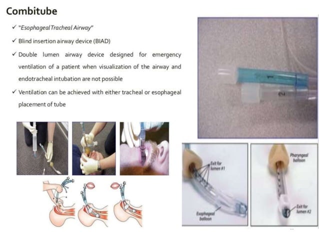 Supraglottic airway devices | PPTX | Ear, Nose and Throat Conditions ...