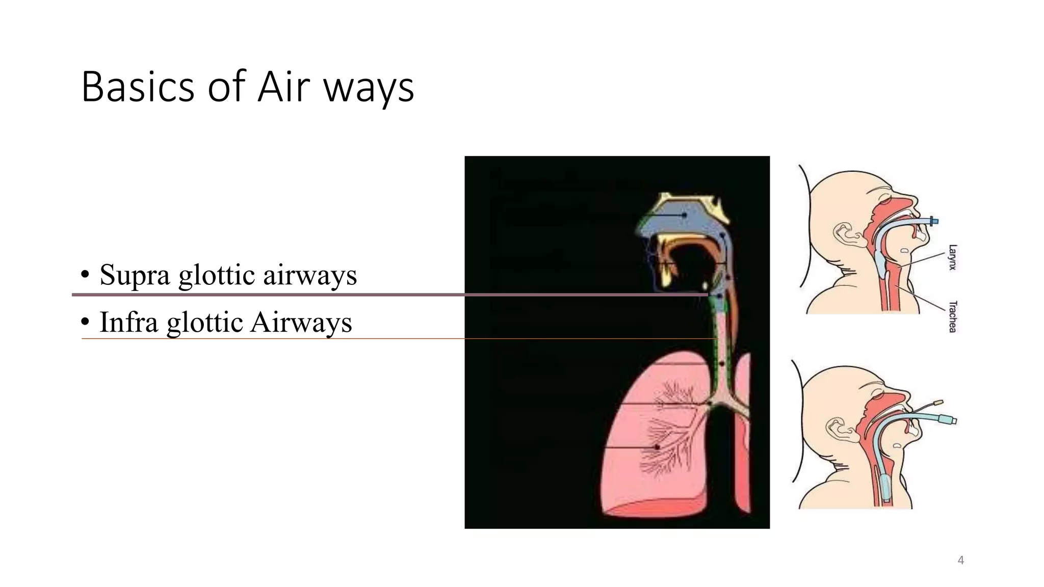 Supraglottic Airway Devices -.pptx