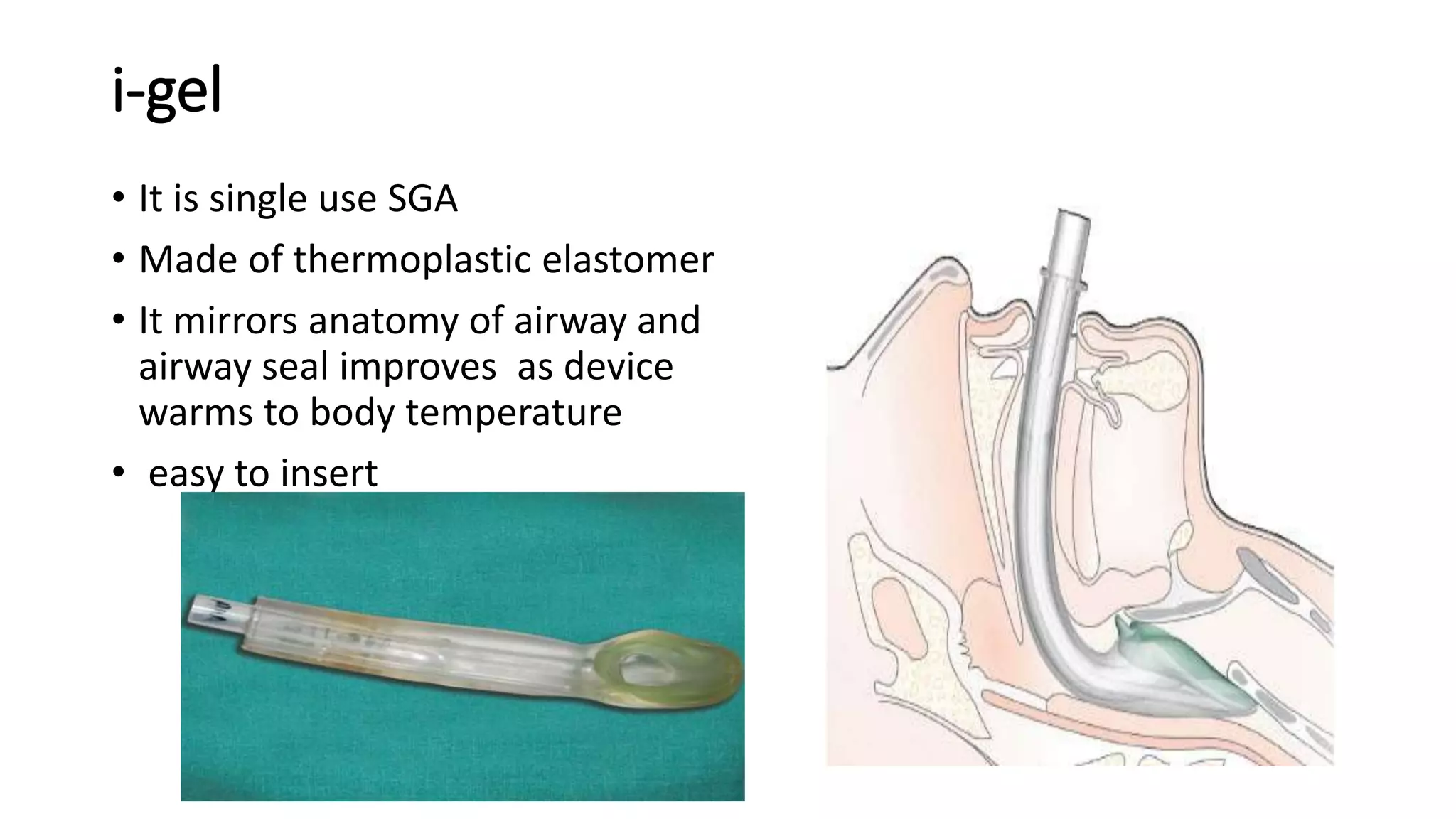 Supraglottic airway devices | PPTX