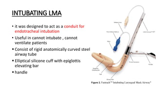 Supraglottic airway devices | PPTX