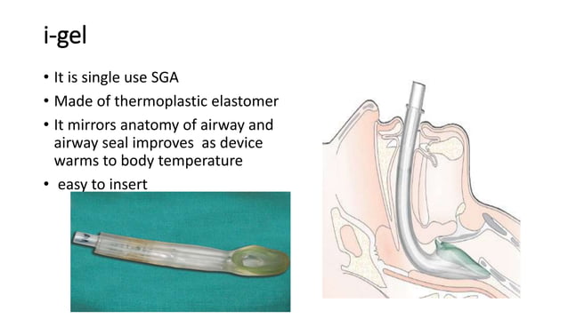 Supraglottic airway devices | PPTX | Ear, Nose and Throat Conditions ...