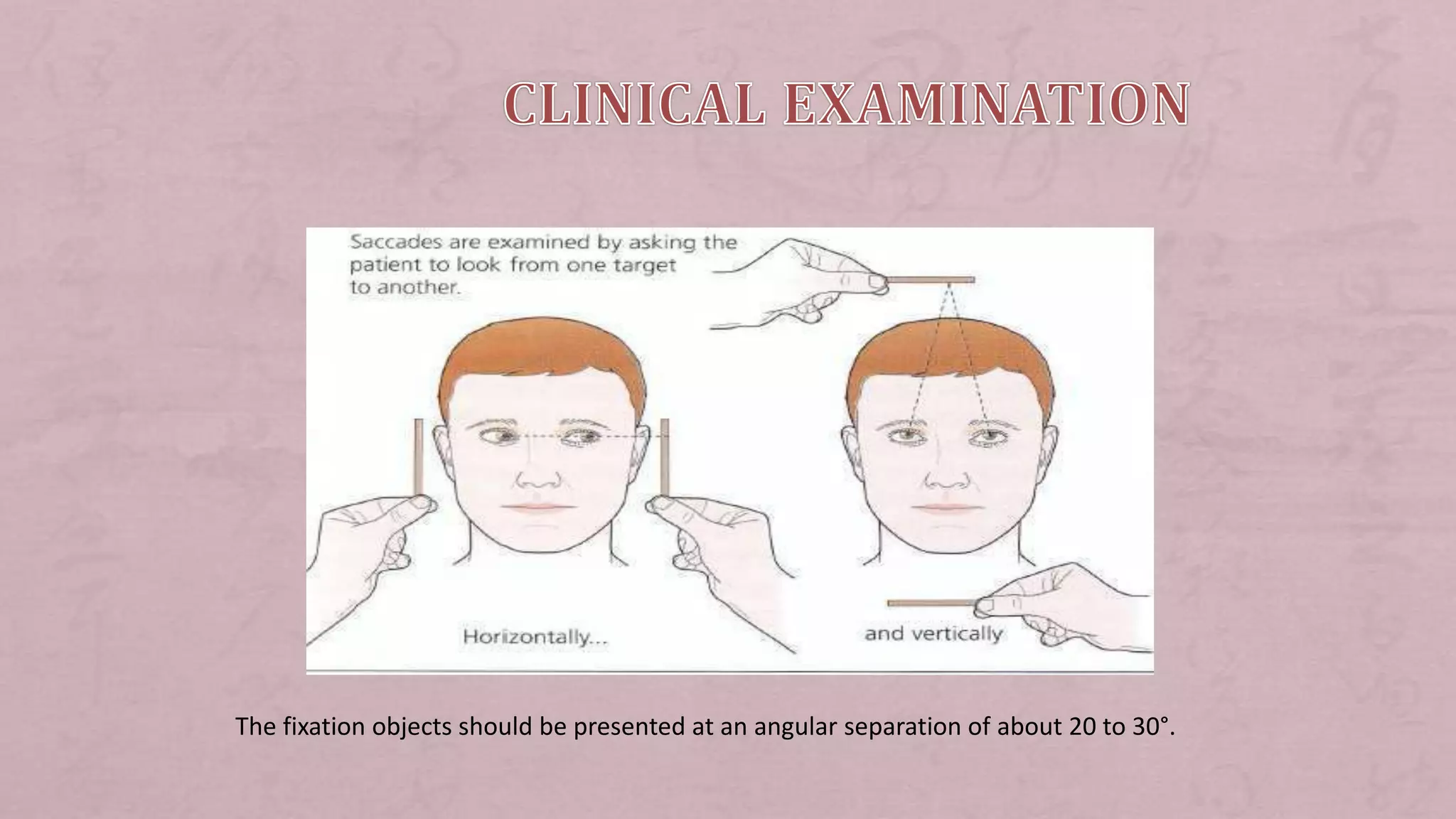 Supranuclear control of eye movements | PPTX