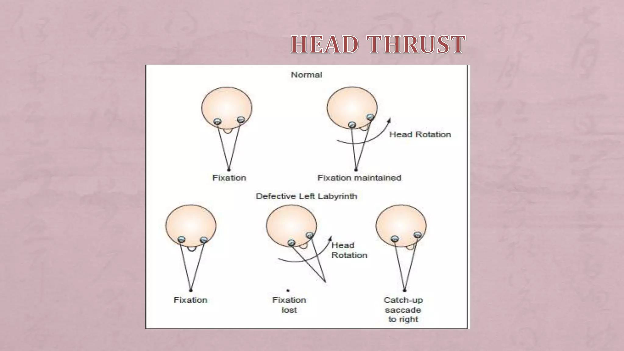 Supranuclear control of eye movements | PPTX