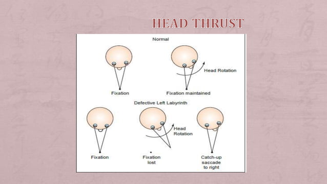 Supranuclear control of eye movements | PPTX