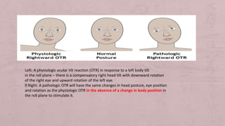 Supranuclear control of eye movements | PPTX