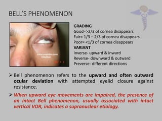 Supranuclearcontrolofgaze 180318184028 | PDF