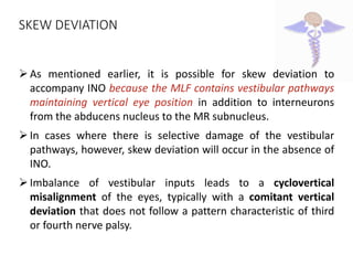 Supranuclear control of gaze | PPTX