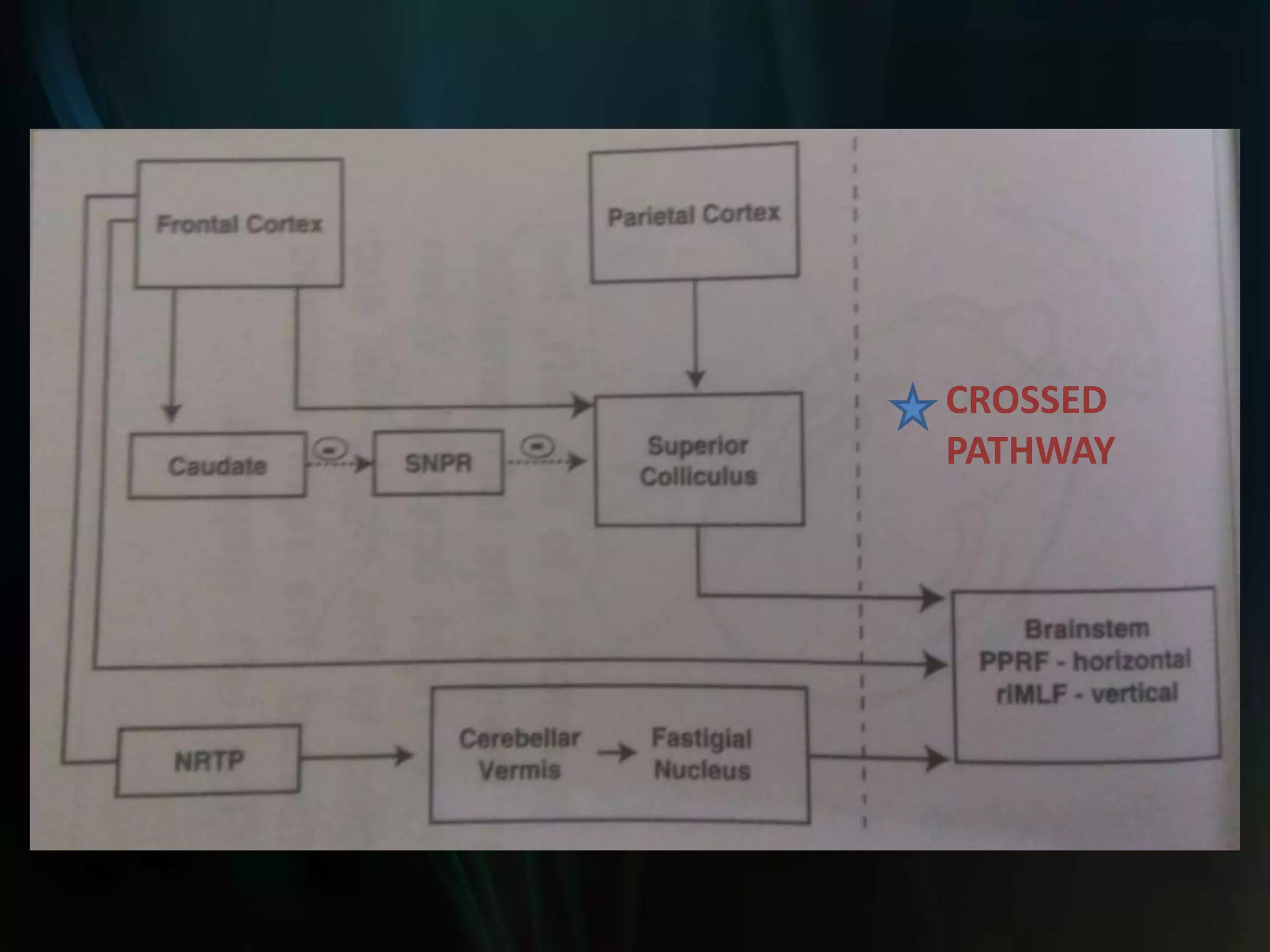 Supranuclear disorders of ocular motility | PPTX