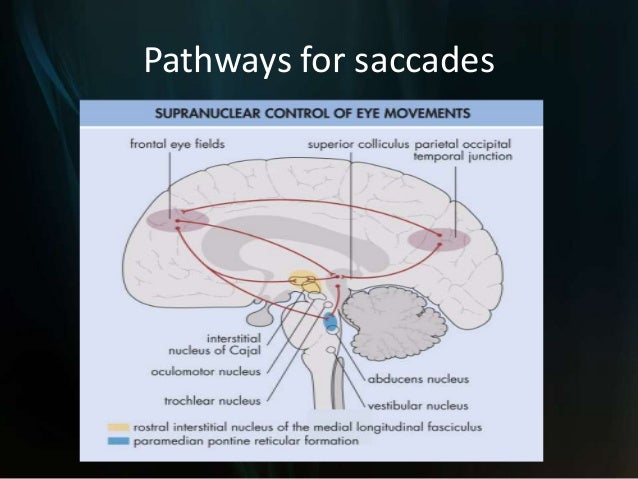 Supranuclear disorders of ocular motility