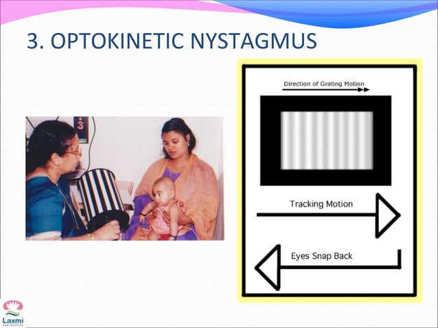 Supranuclear pathways and lesions | PPTX