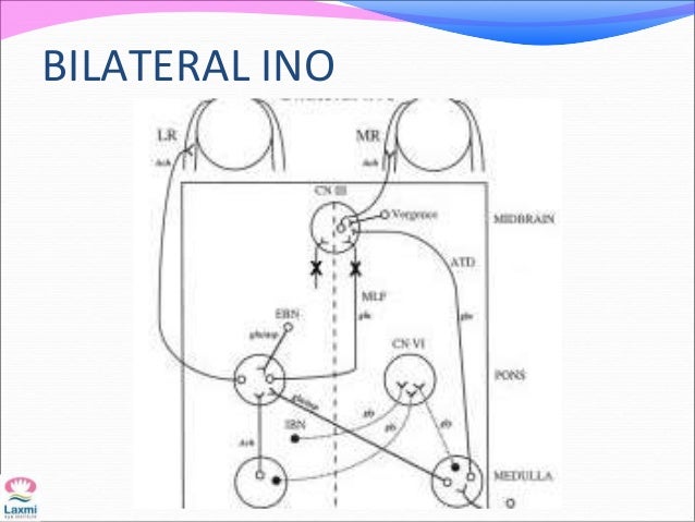 Supranuclear pathways and lesions