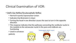 Supranuclear control of eye movements in ophthalmology | PPTX