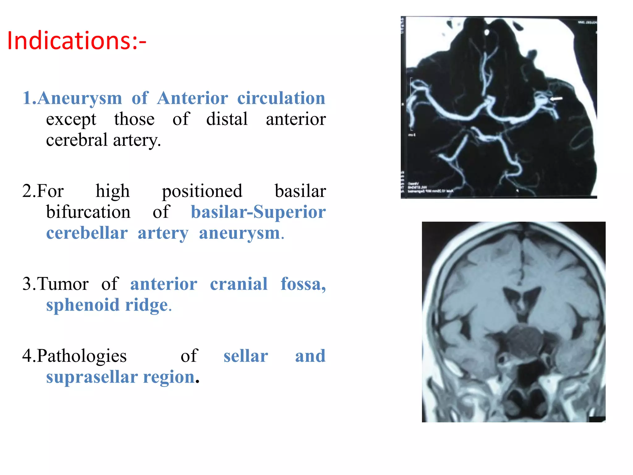 Supraorbital craniotomy. | PPTX