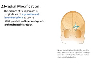 Supraorbital craniotomy. | PPTX