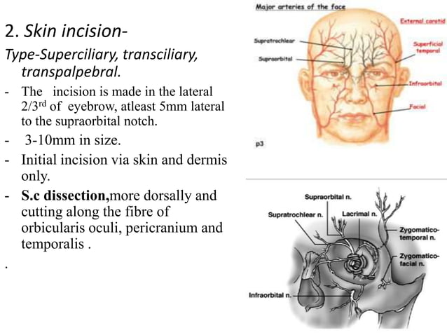 Supraorbital craniotomy. | PPT