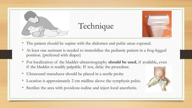 Suprapubic Aspiration By Essam Sidqi | PPTX